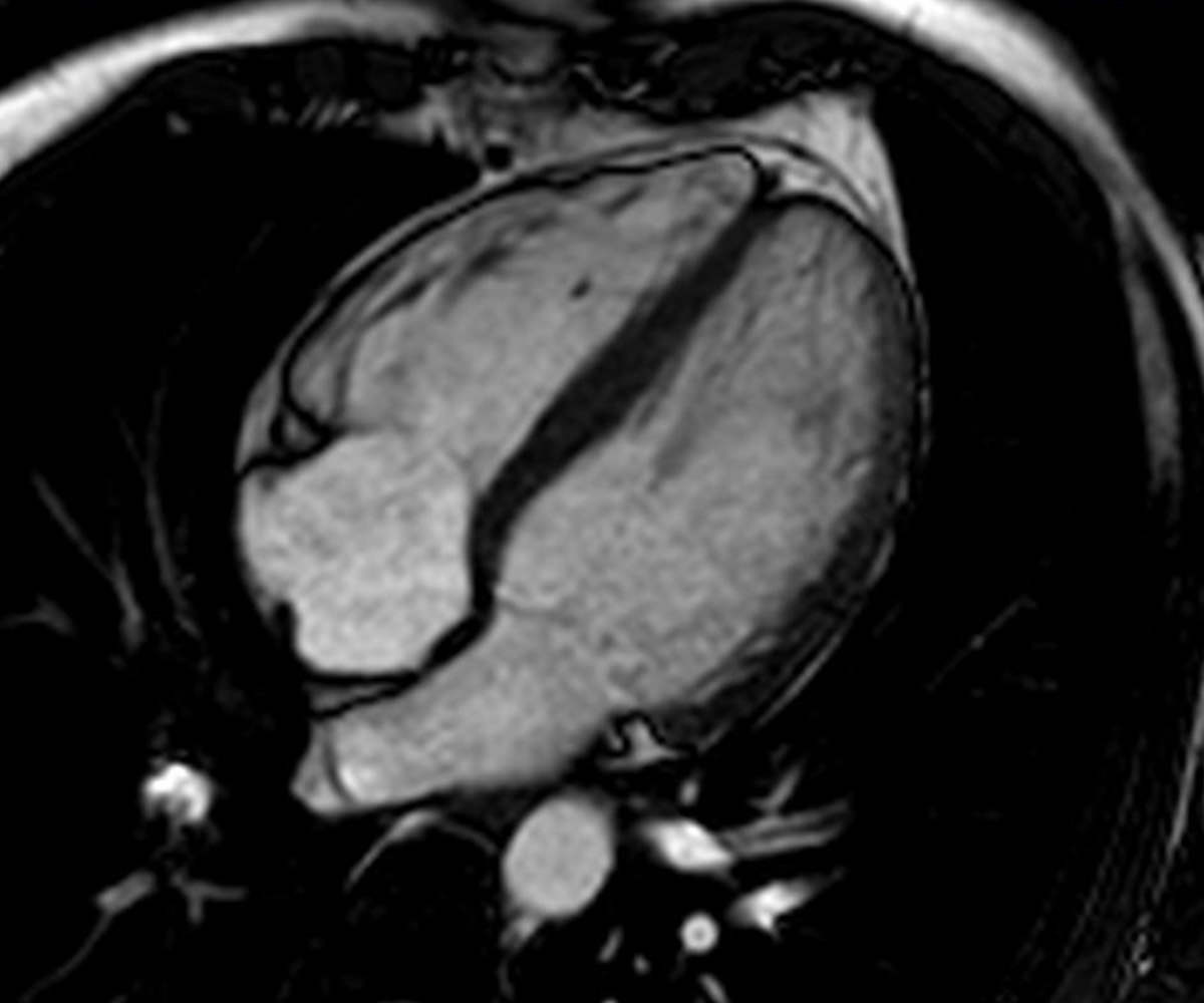 Kardio-MRT Düsseldorf Benrath - Kardiologie in der Klinik